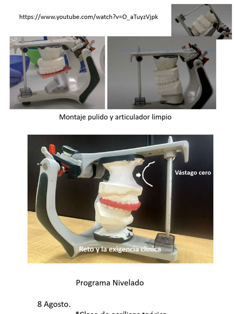 Clase 3ro 2024 II PLACAS NMR-FERULAS OCLUSALES | PDF