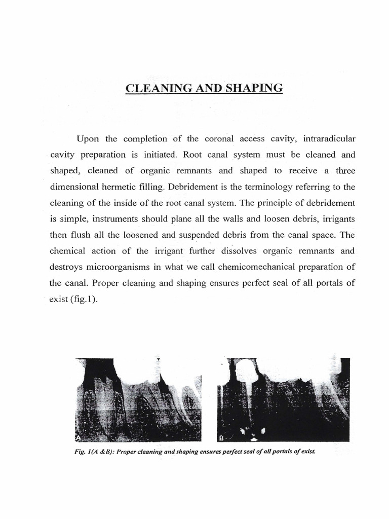 Cleaning & Shaping | PDF