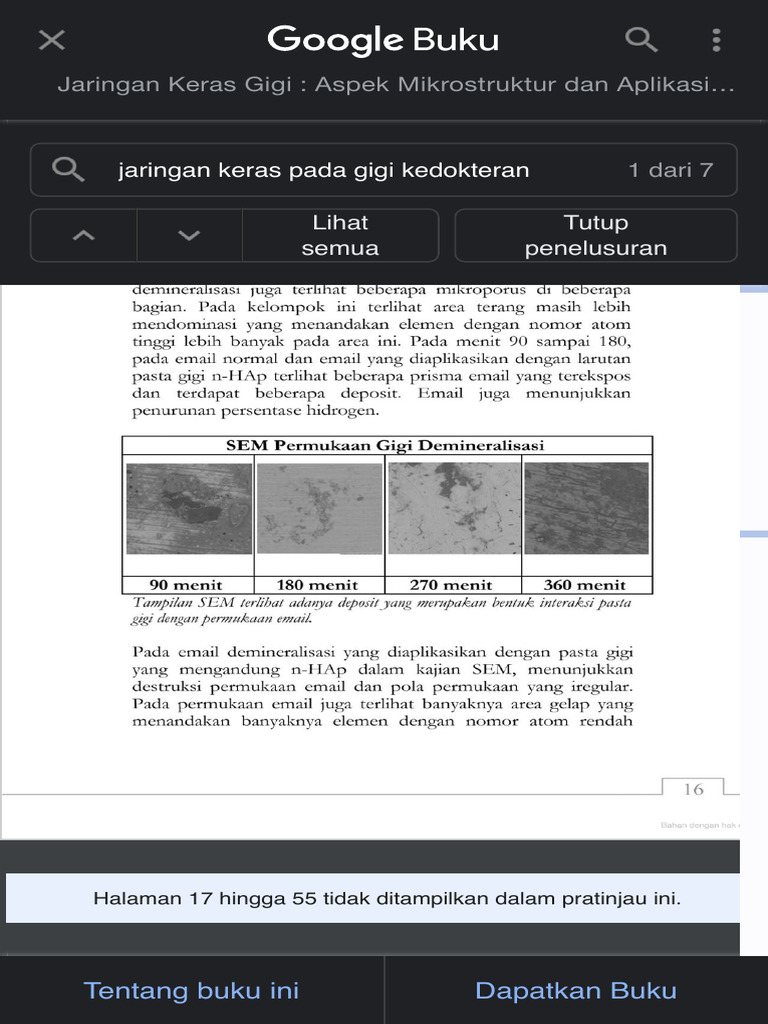 Jaringan Keras Gigi Aspek Mikrostruktur Dan Aplikasi Riset - Abdillah Imron Nasution - Google ...