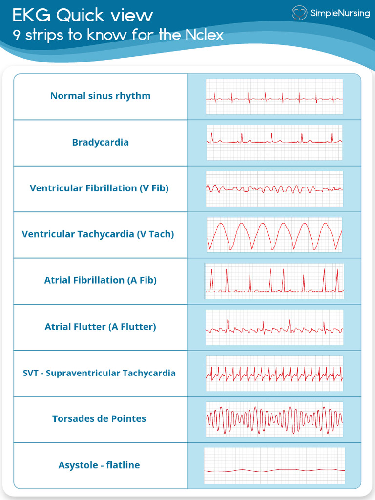 ECG Quick View | PDF