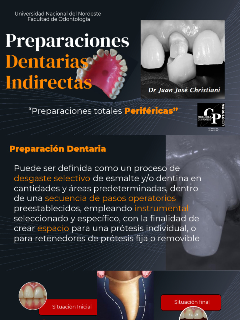 PREPARACIONES DENTARIAS Indirectas Totales Perfericas-IOR-2020 | PDF