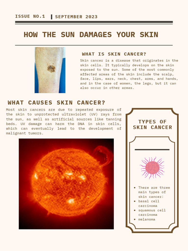 Skin Cancer Article | PDF