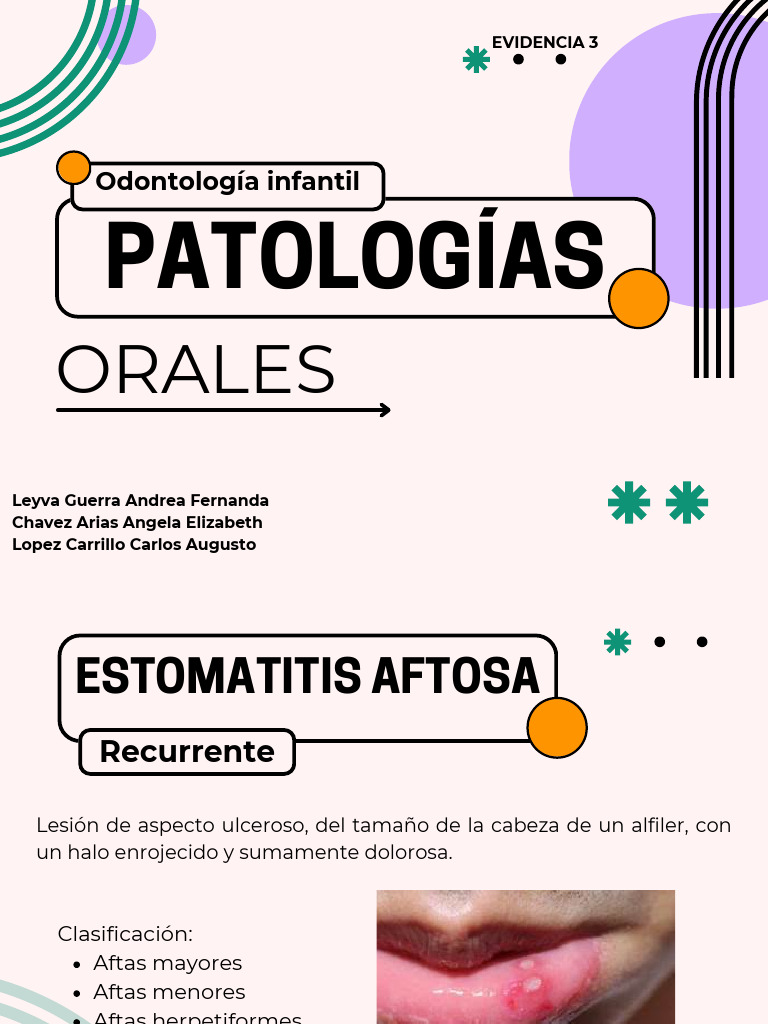 Evidencia3.inf 20240818 215100 0000 | PDF