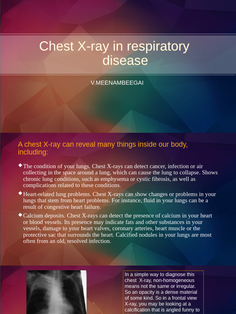 Chest X-Ray | PDF
