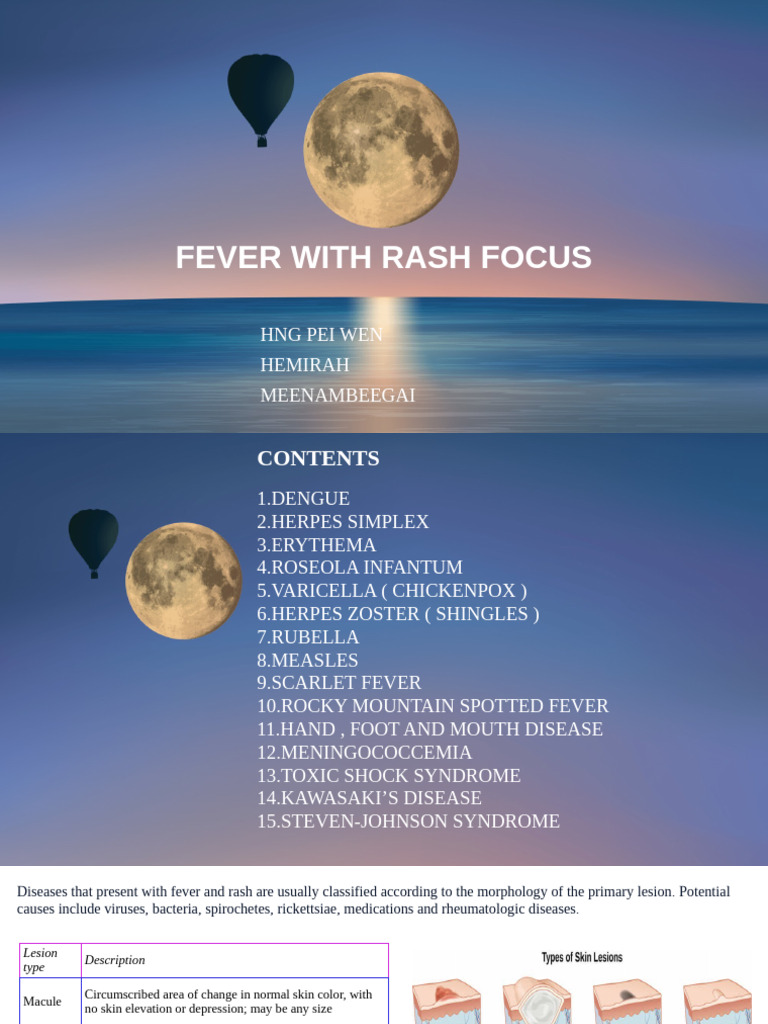 Fever With Rash | PDF
