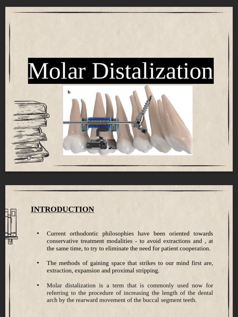 Seminar Presentation Distalisation of Molars | PDF