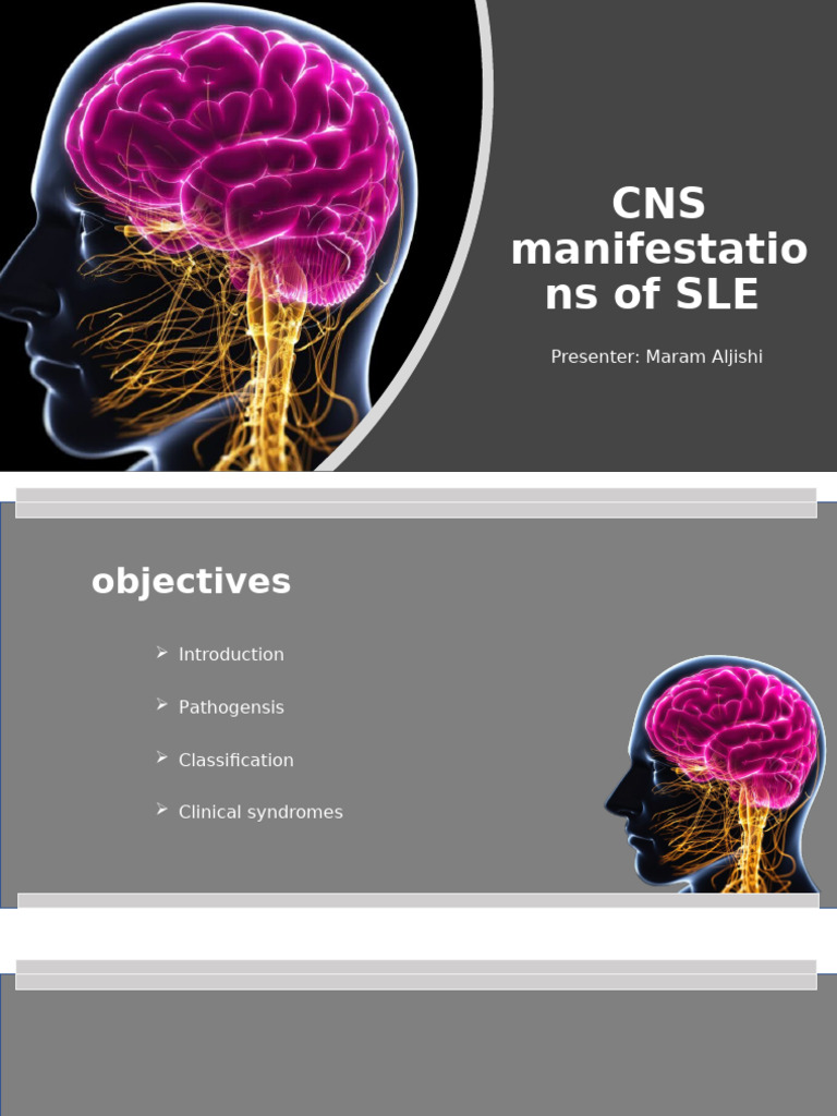 Sle CNS | PDF
