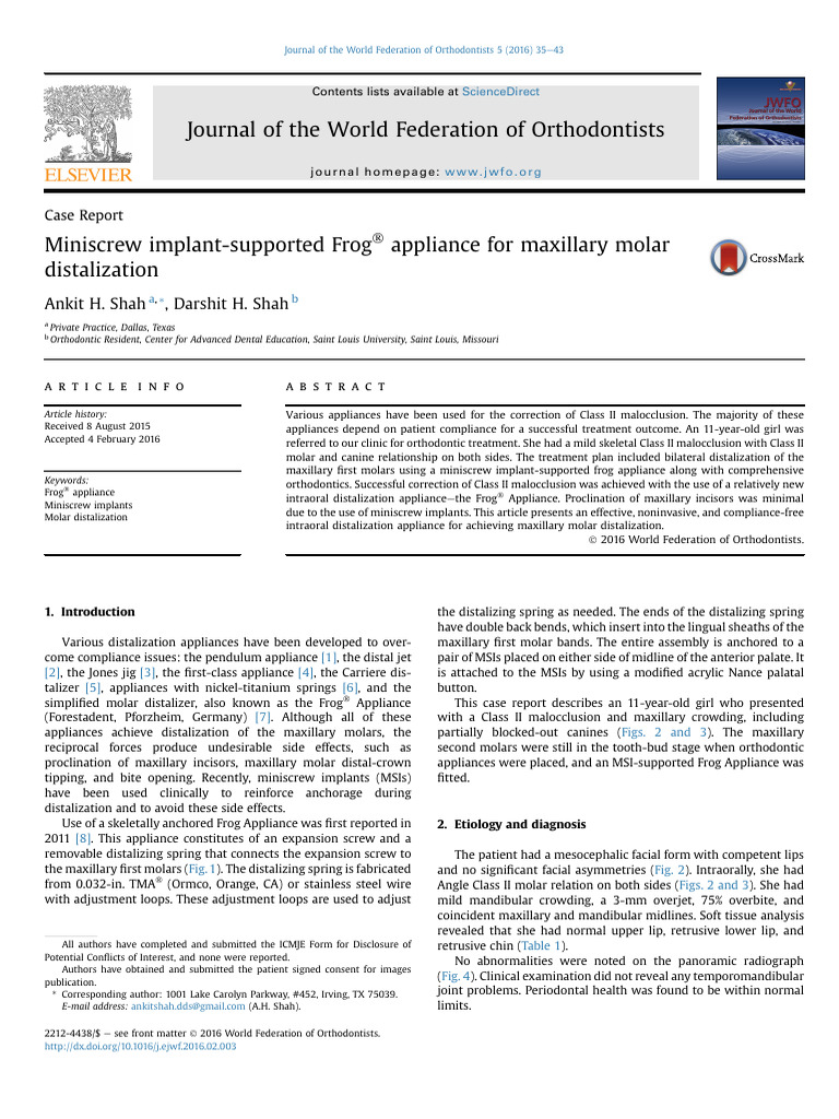 Miniscrew Implant Supported Frog Appliance For Maxillary Molar ...