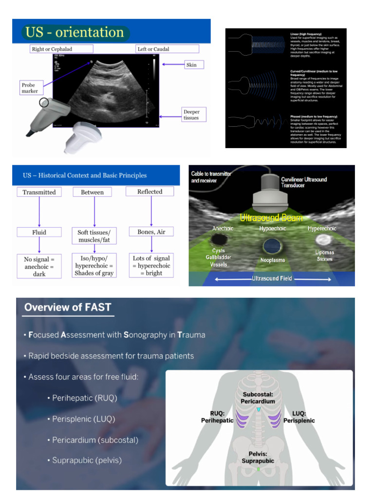 eFAST Ultrasound | PDF