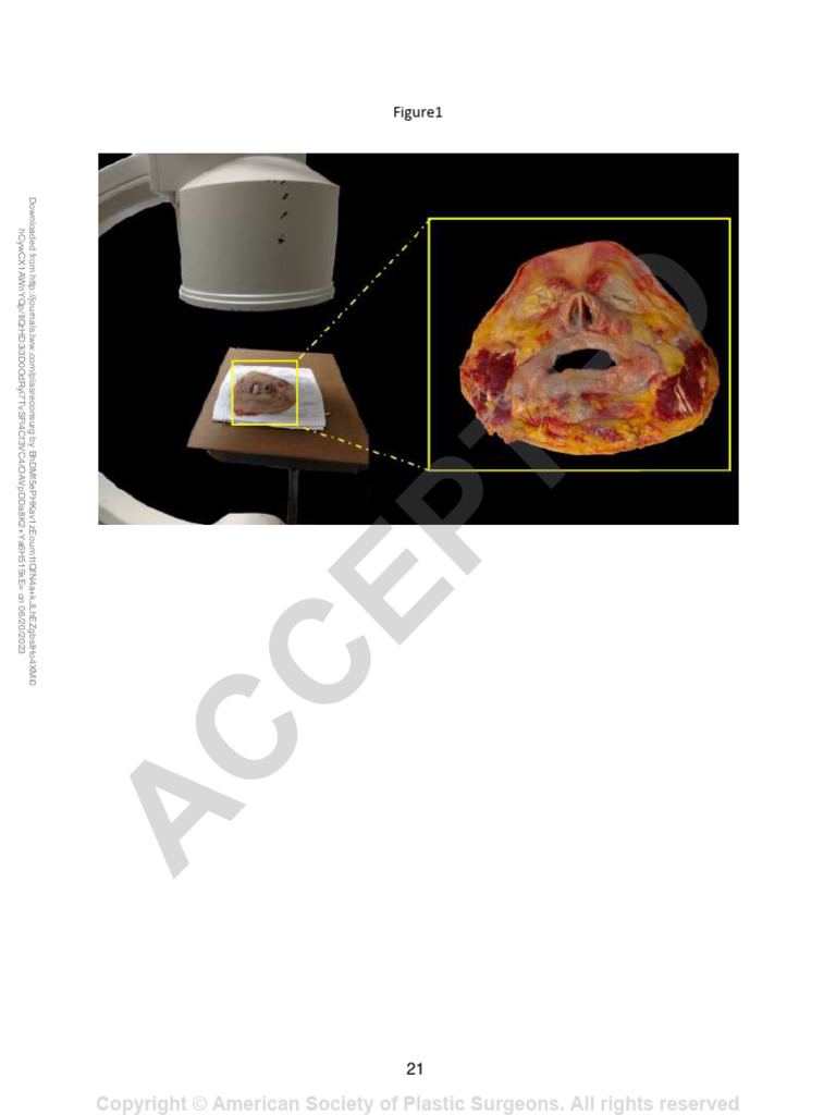 Cotofana S, Et Al 2023 Intralabial Lip Compartments and Their Potential ...