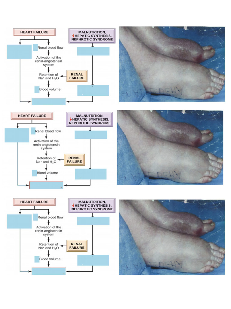 Edema Prints | PDF