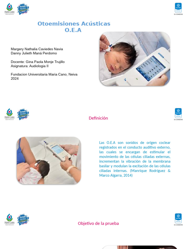 Otoemisiones Acusticas | PDF