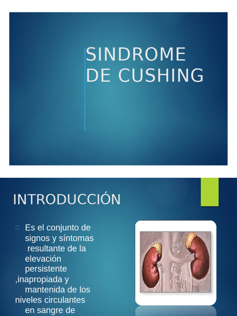 Cushing | PDF