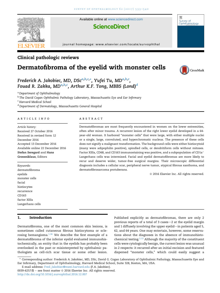 Dermatofibroma of The Eyelid With Monster Cells - 2017 - Survey of ...