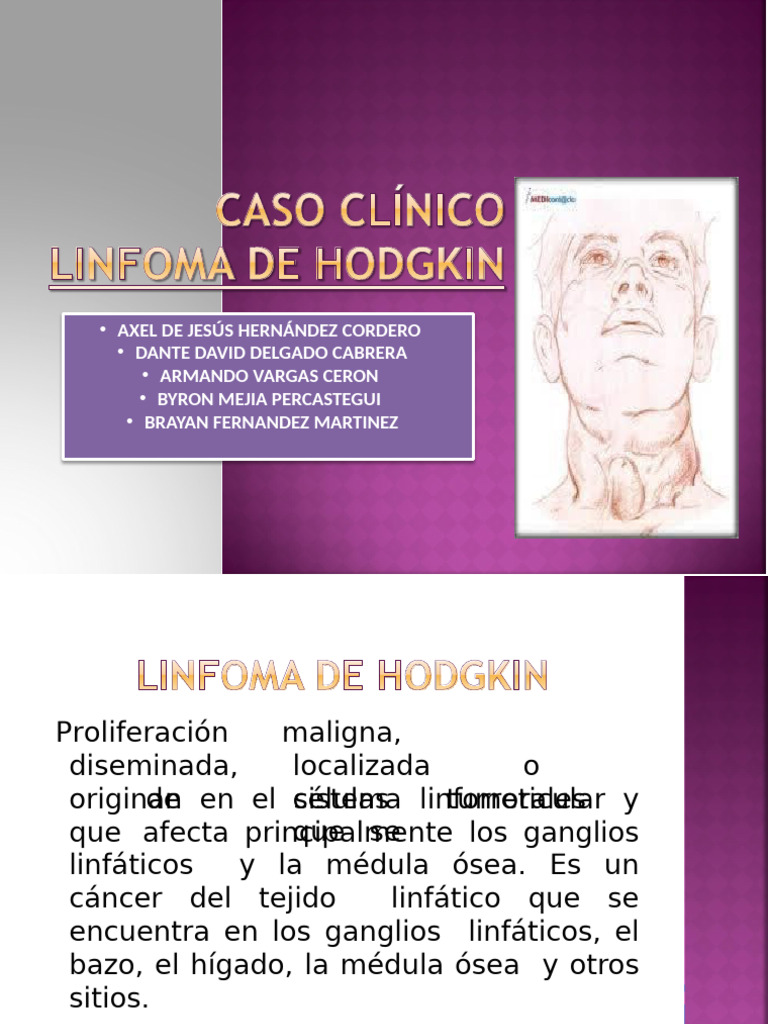 CASO CLINICO Linfoma de Hodgkin | PDF
