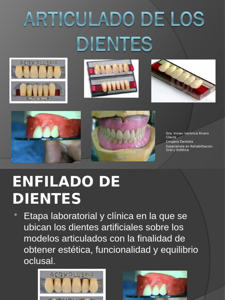 Selección y Enfilado de Dientes Artificiales | PDF | Odontología