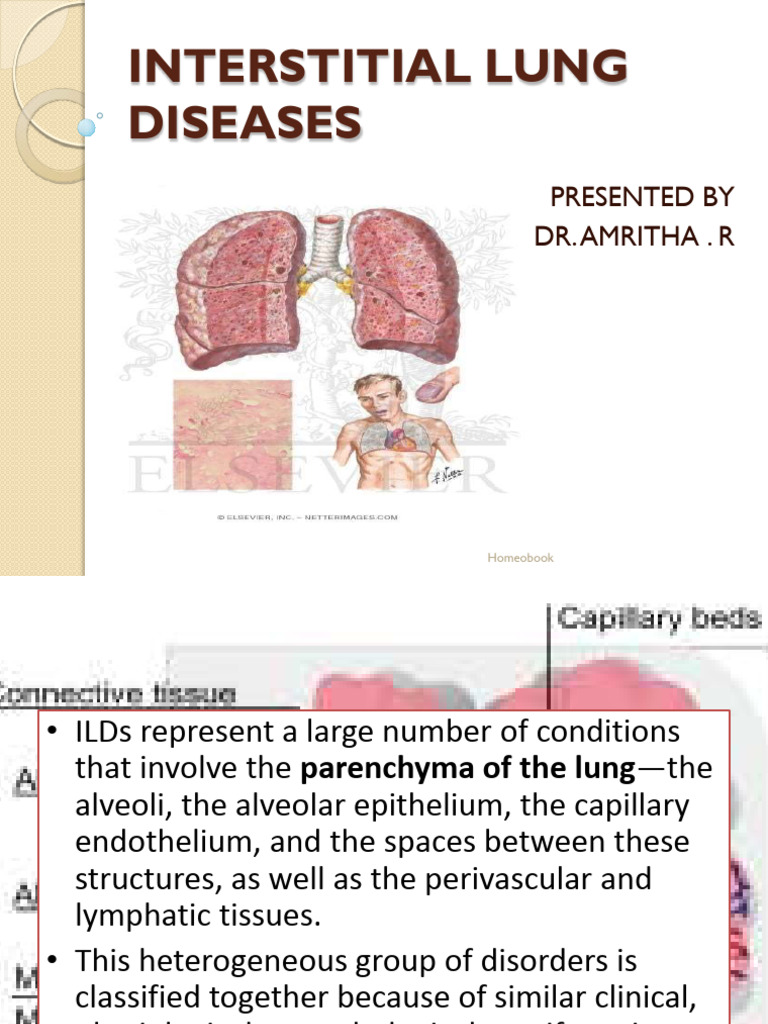 A Case of Interstitial Lung Diseases | PDF | Respiratory Diseases | Lung