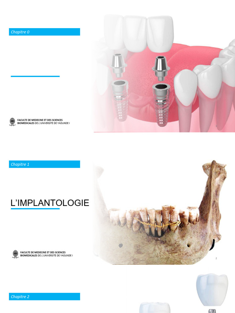 1-Programme Mbd4 + Chapitre 1 Mbd4 | PDF