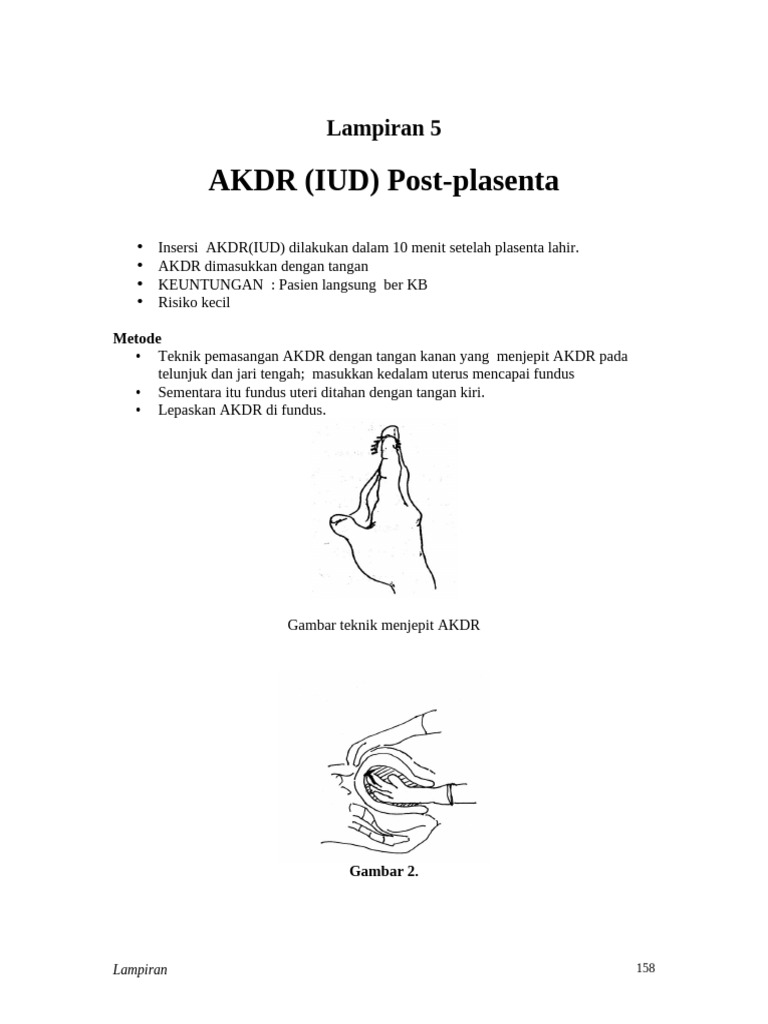 Lampiran 5 - IUD - Postpartum | PDF