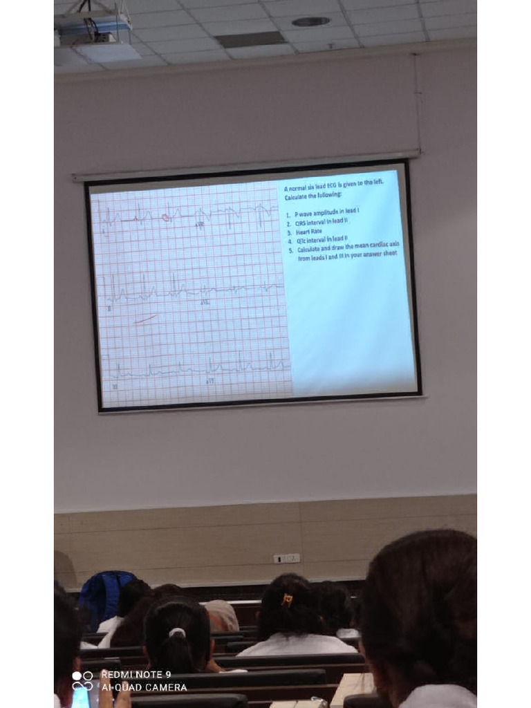 ECG Charts with Complete Answers | PDF