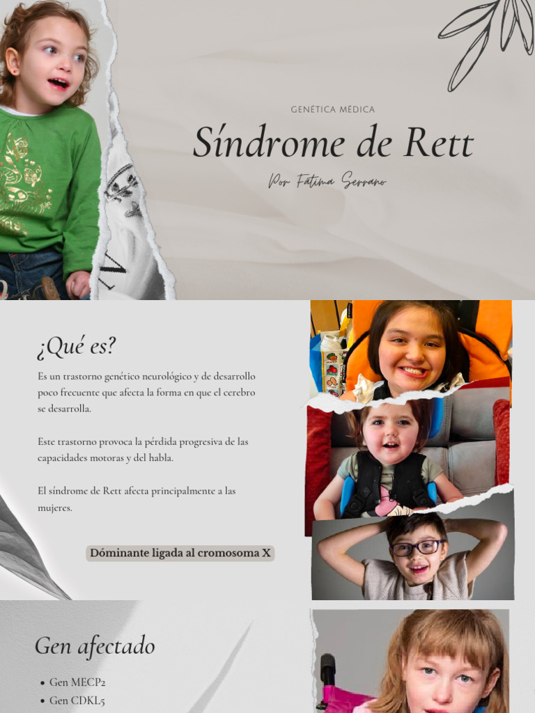 Síndrome de Rett | PDF