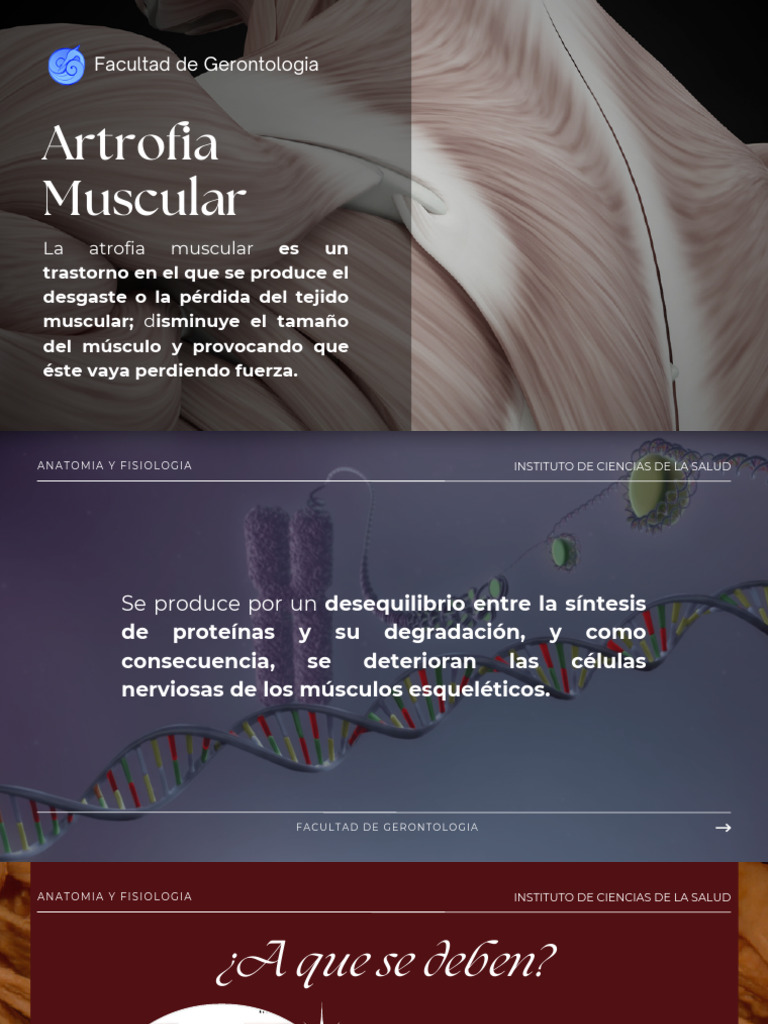 Atrofia Muscular | PDF