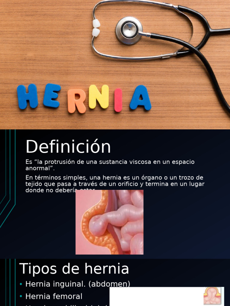Hernia | PDF