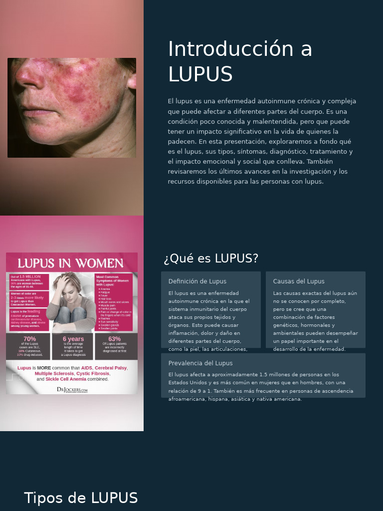 Lupus | PDF