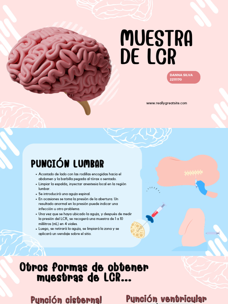Muestra de lcr | PDF