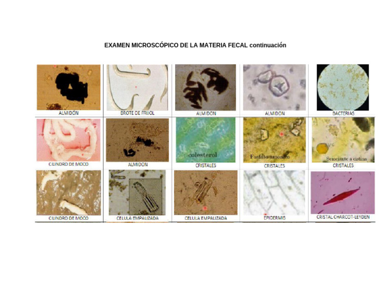 Examen Microscópico de La Materia Fecal | PDF
