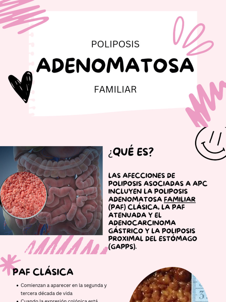 Poliposis adenomatosa familiar | PDF