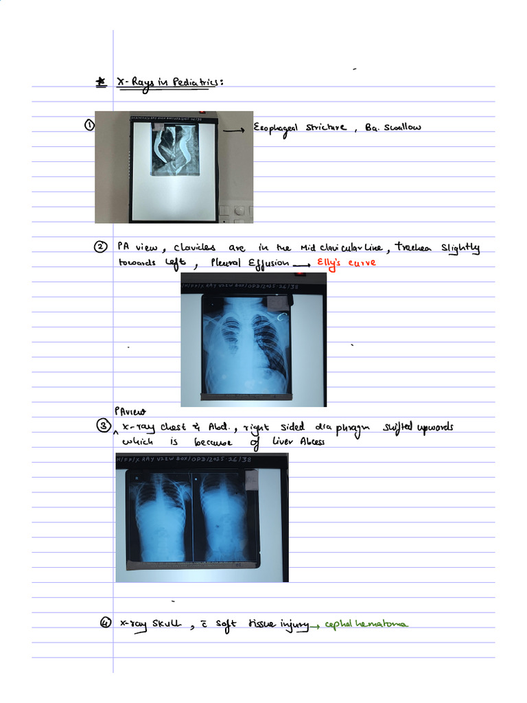 X Rays | PDF