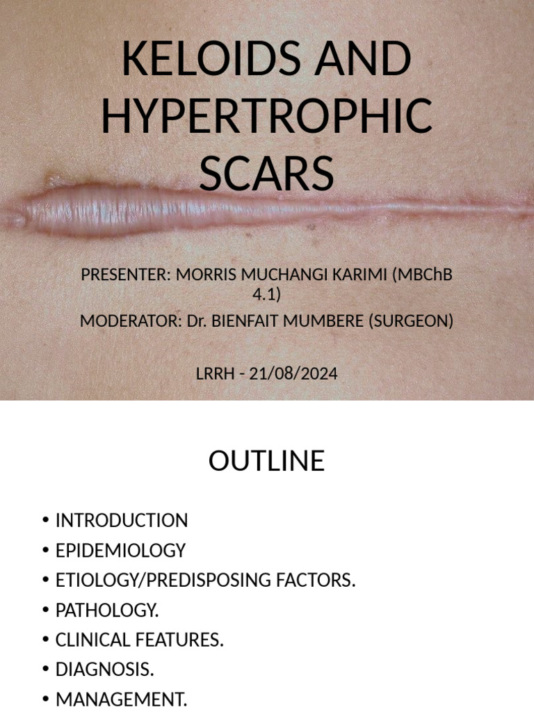 KELOIDS AND HYPERTROPHIC SCARS | PDF
