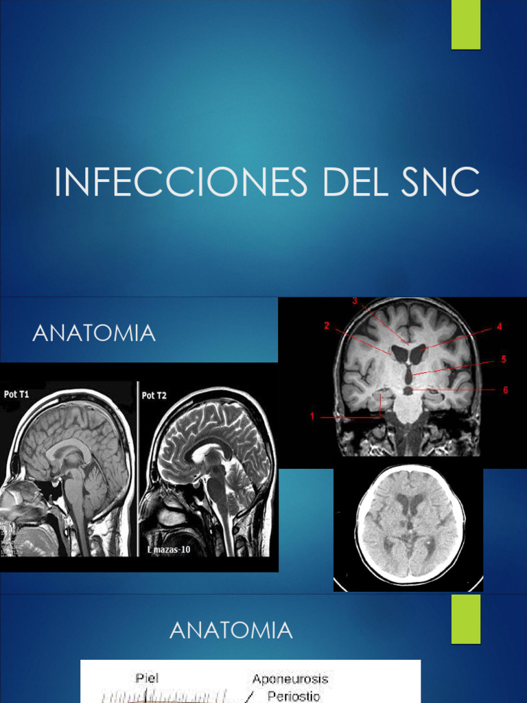 Infecciones Del Snc 2023 | PDF