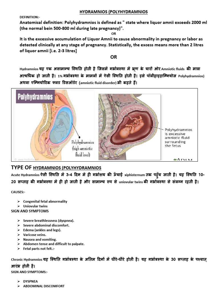Hydramnios (Polyhydramnios | PDF