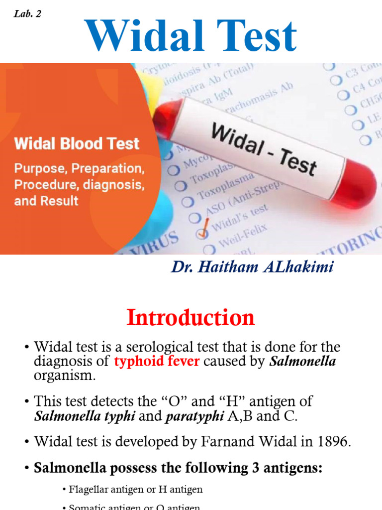 Widal Test - Practical | PDF