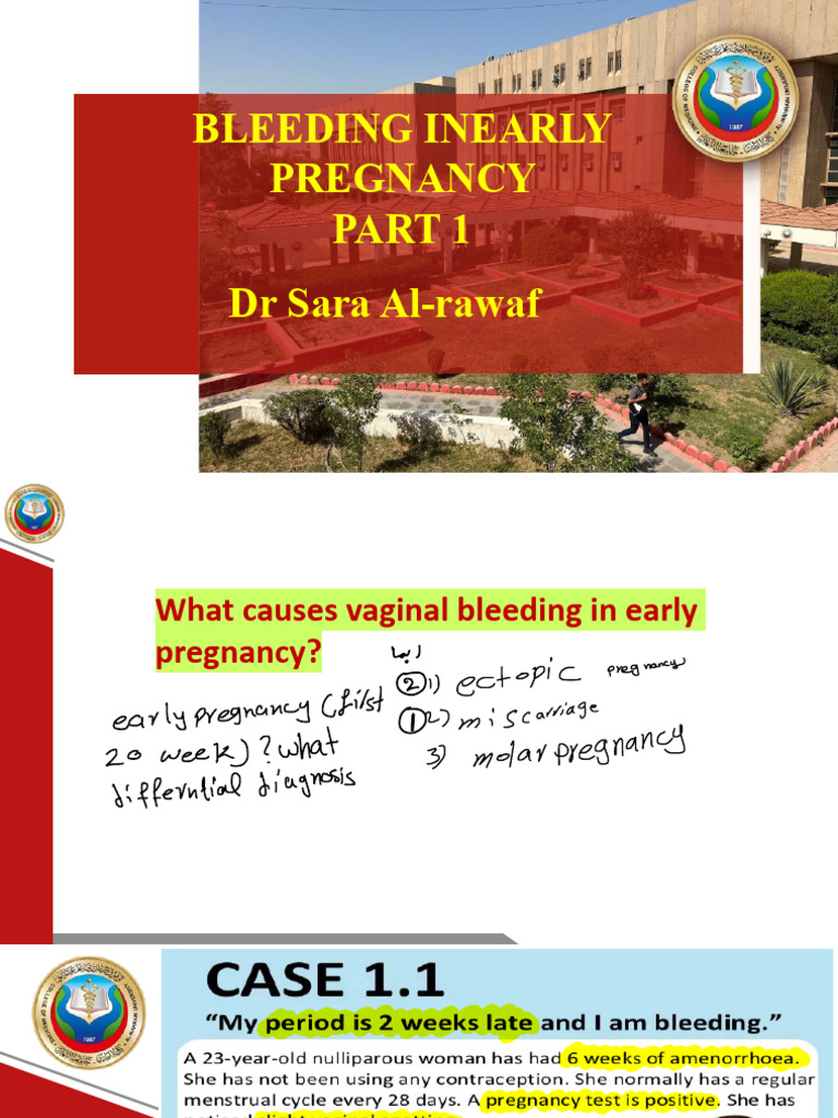 Miscarriage | PDF | Miscarriage | Science & Mathematics