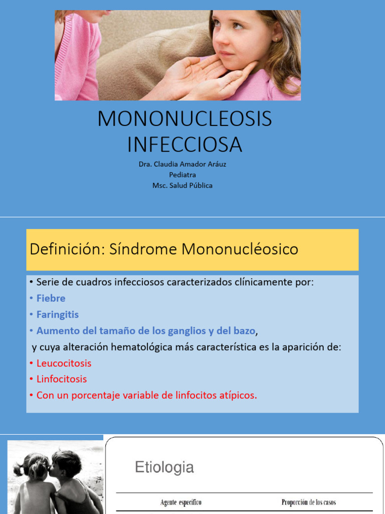 Clase 31. Mononucleosis Infecciosa | PDF
