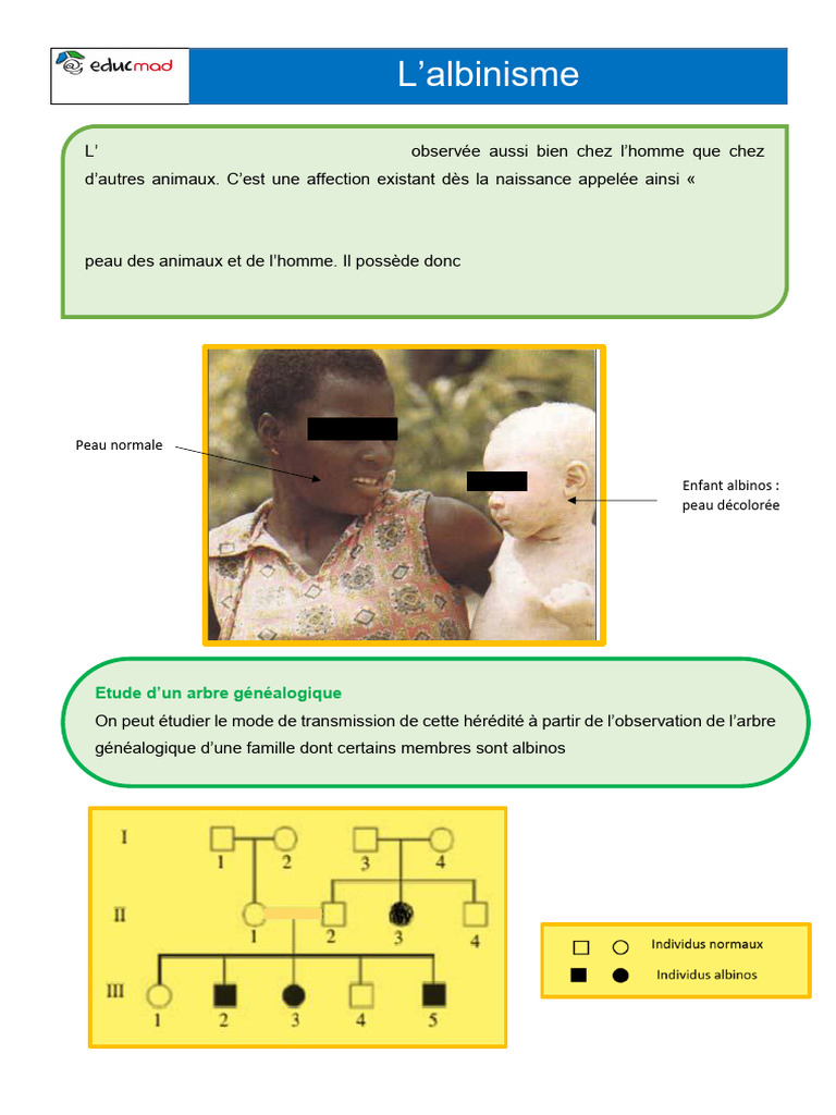 Albinisme | PDF