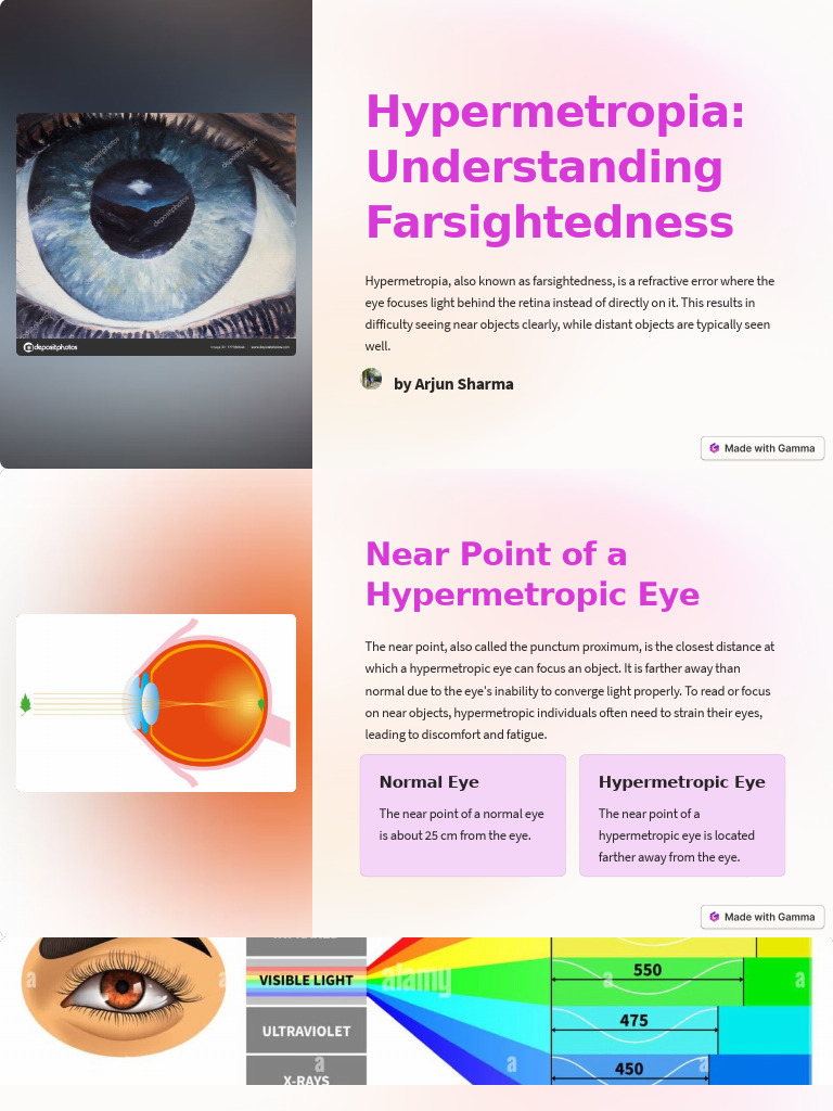 Hypermetropia Understanding Farsightedness | PDF