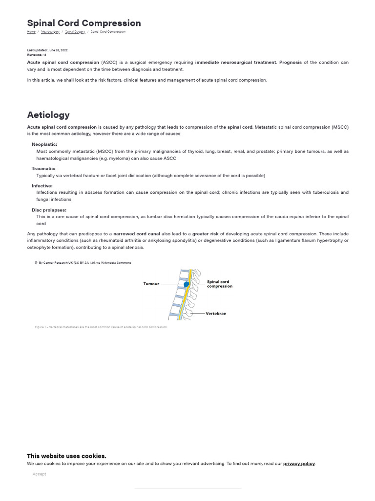 Spinal Cord Compression - Clinical Features - Decompression - TeachMeSurgery | PDF | Diseases ...