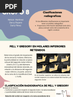 Clasificación de Pell y Gregory | PDF