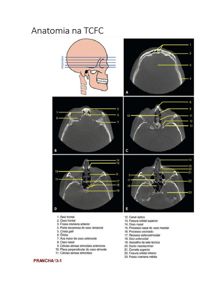 Anatomia na TCFC | PDF