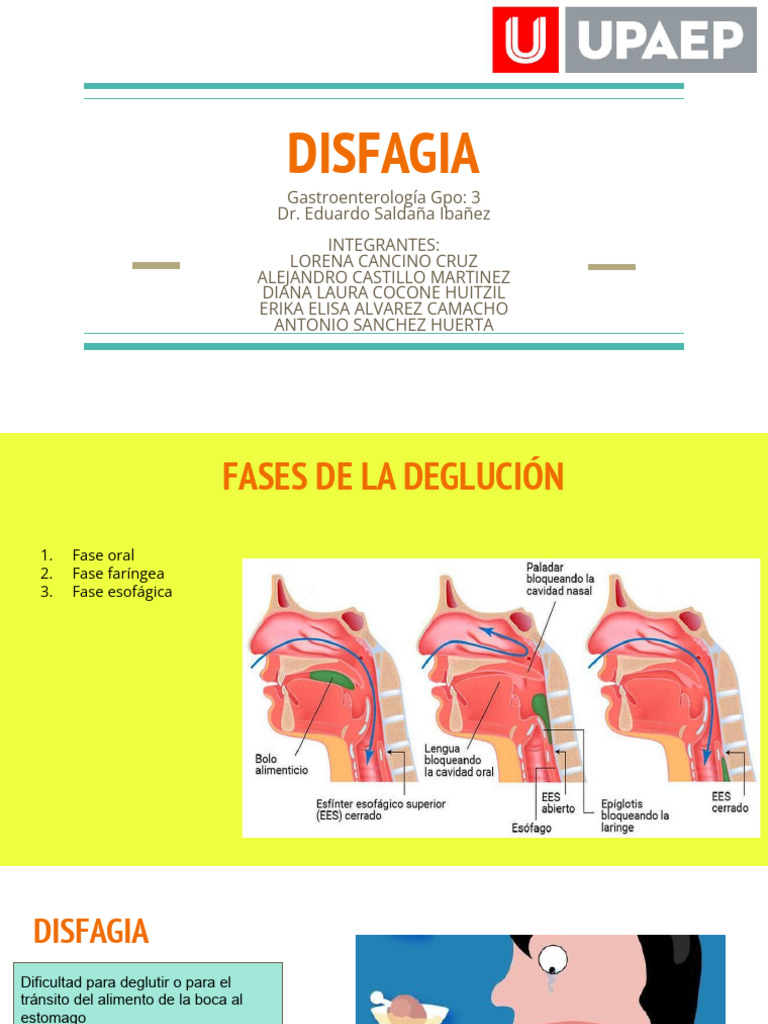 DISFAGIA | PDF