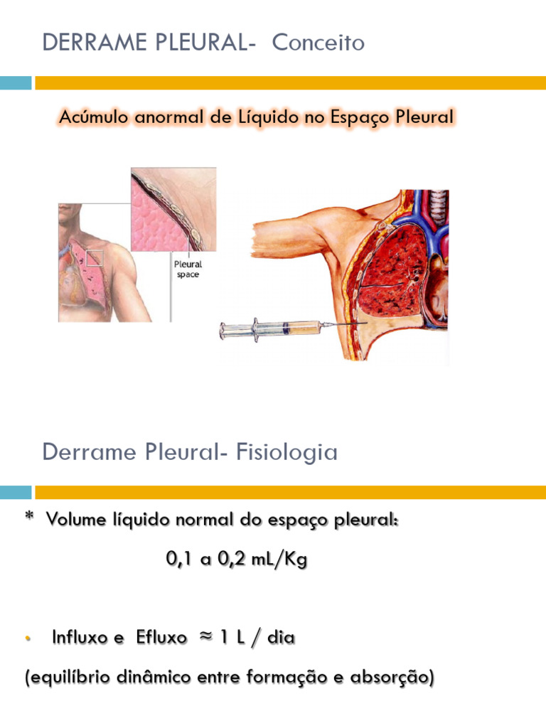 Derrame Pleural e Empiema Pleural | PDF