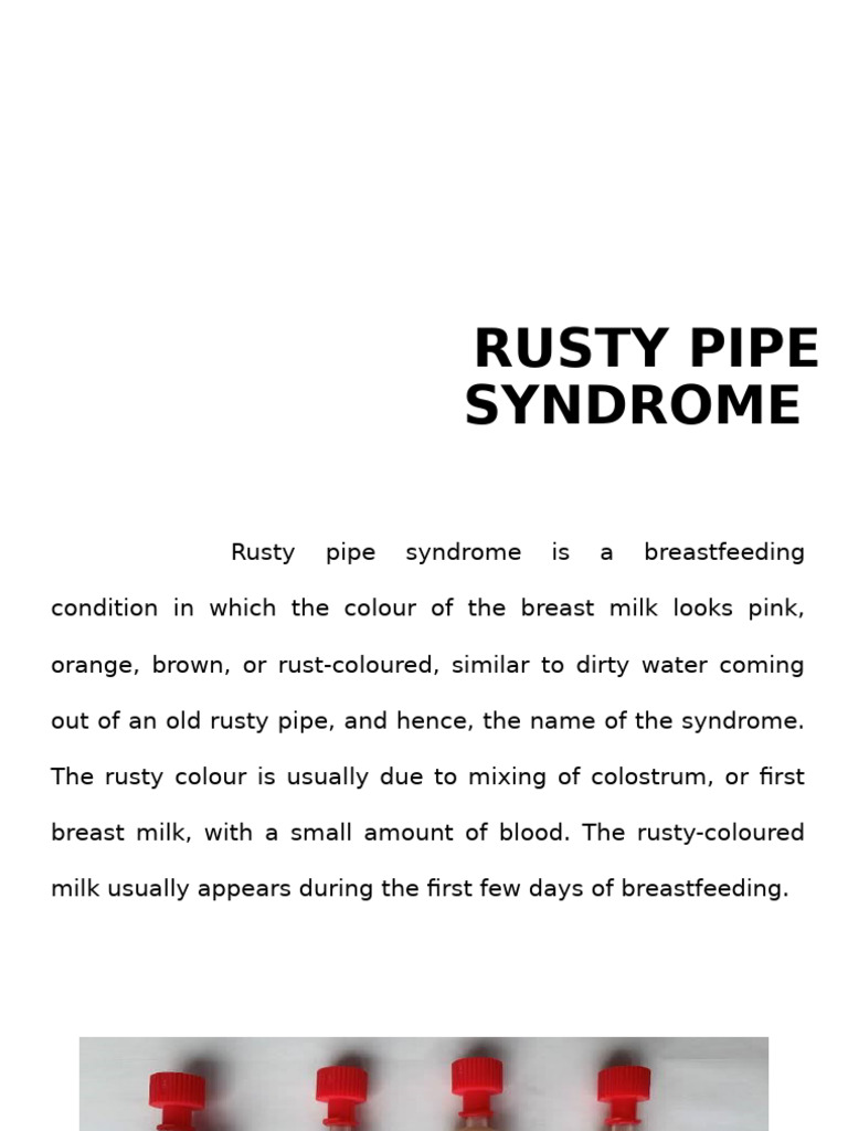 Rusty Pipe Syndrome | PDF