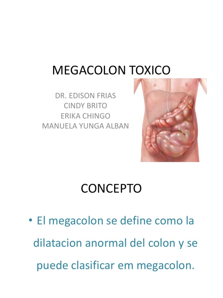 Megacolon Toxico | PDF | Enfermedad de Crohn | Gastroenterología