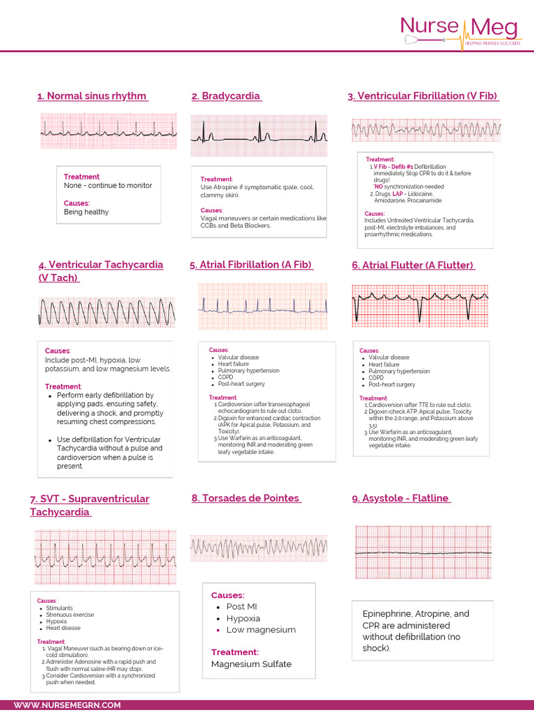EKG Strips | PDF