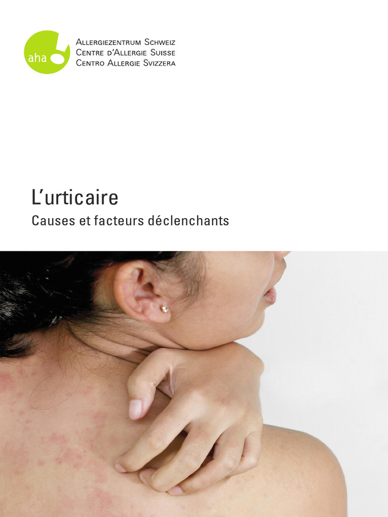 L Urticaire | PDF