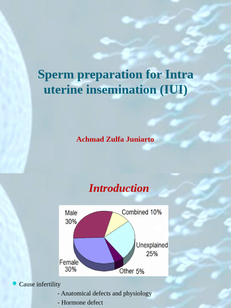 Washing Sperm Gradient Density | PDF